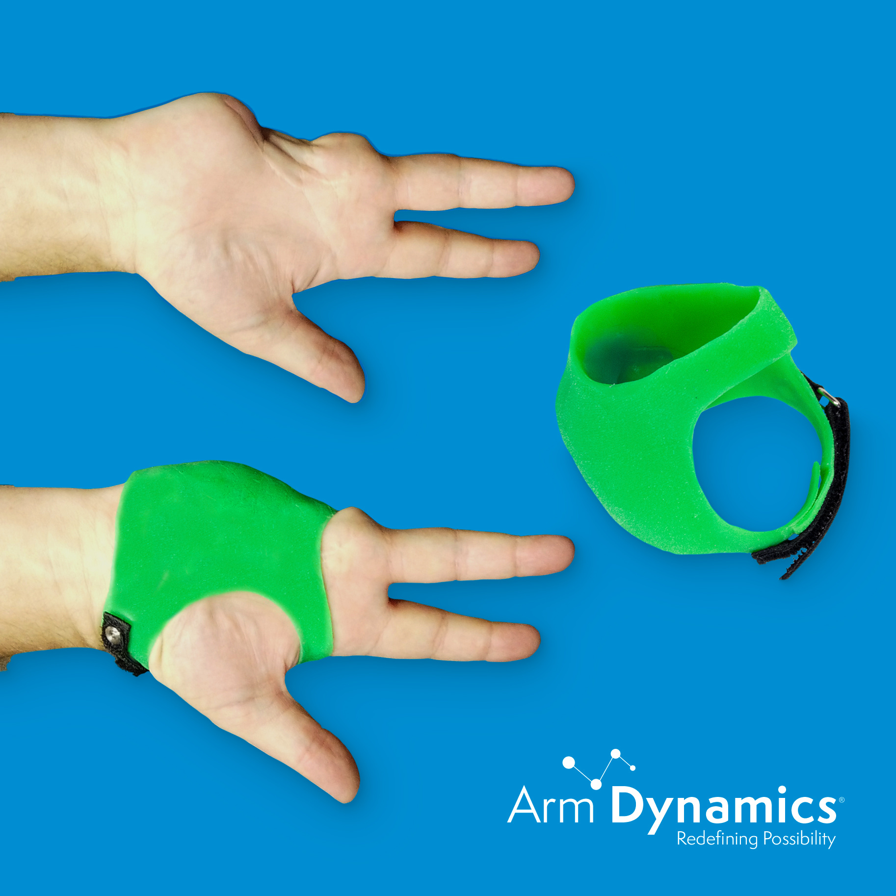 Upper Limb Prostheses Function And Protection 8307